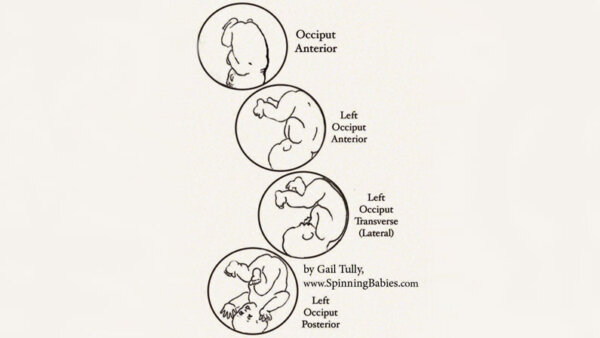 Flexion Matters - Spinning Babies