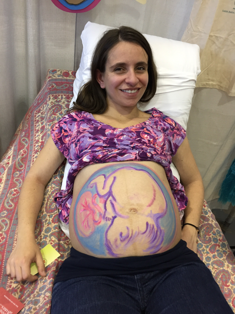 Left Occiput Anterior (LOA) - Spinning Babies