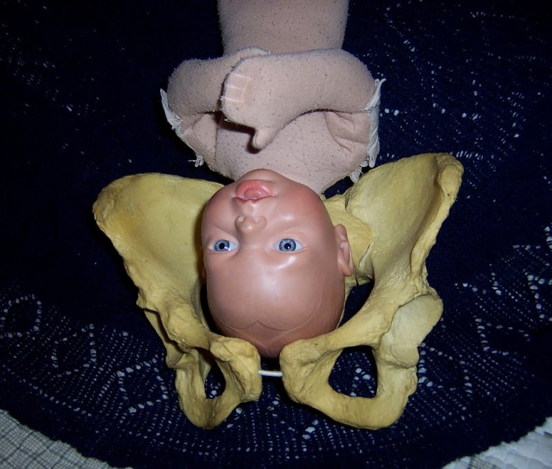 Parent Education and Fetal Position - Spinning Babies