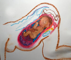 More Cervical Lip Solutions - Spinning Babies