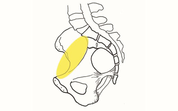 Solutions for Dystocia in the Levels of the Pelvis - Spinning Babies