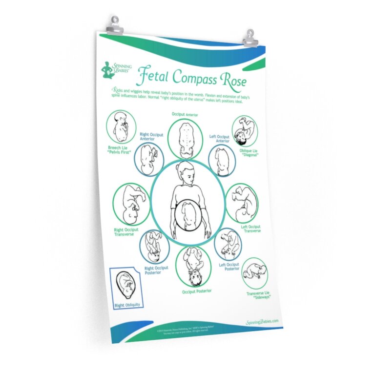 Spinning Babies® Badge Buddies - Spinning Babies